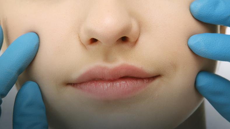 Budowa ust, anatomia i topografia okolicy ustnej – Monika Sekita-Pilch