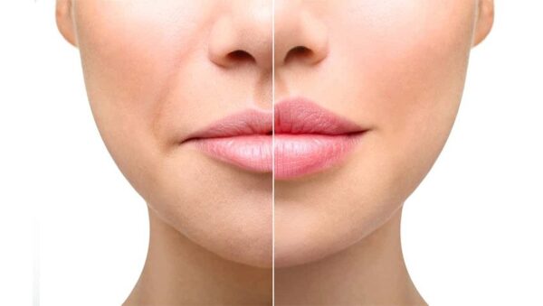 Budowa ust, anatomia i topografia okolicy ustnej – Monika Sekita-Pilch